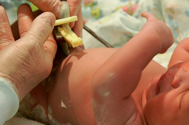 Autismo pode estar relacionado ao sangue do cordão umbilical; entenda ...